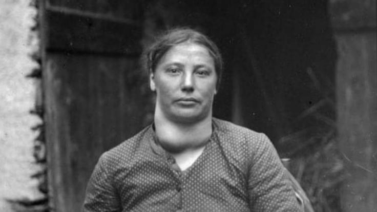 « Un Crétin des Alpes », les origines de cette expression - Le Pays Gessien